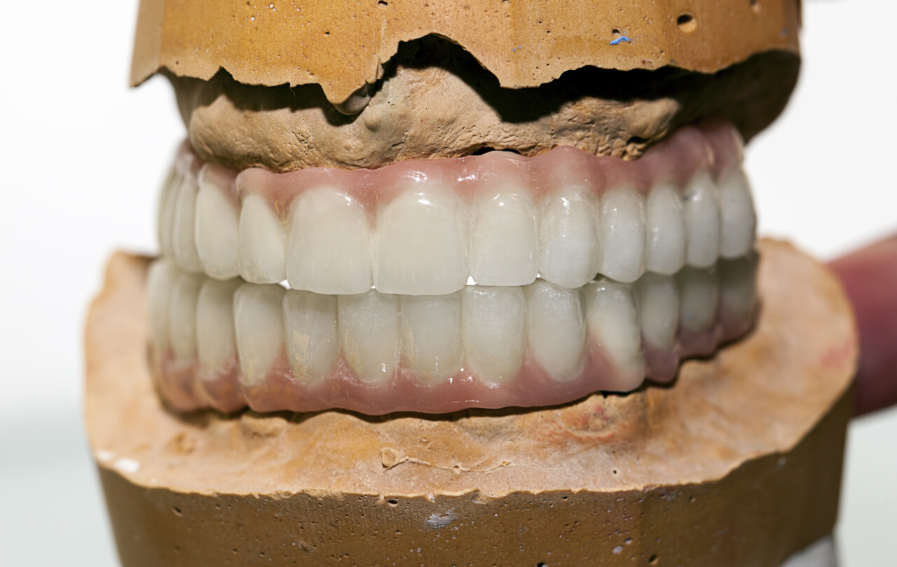 Fixed Prosthesis vs. Removable Prosthesis: Which is the Best Option for ...